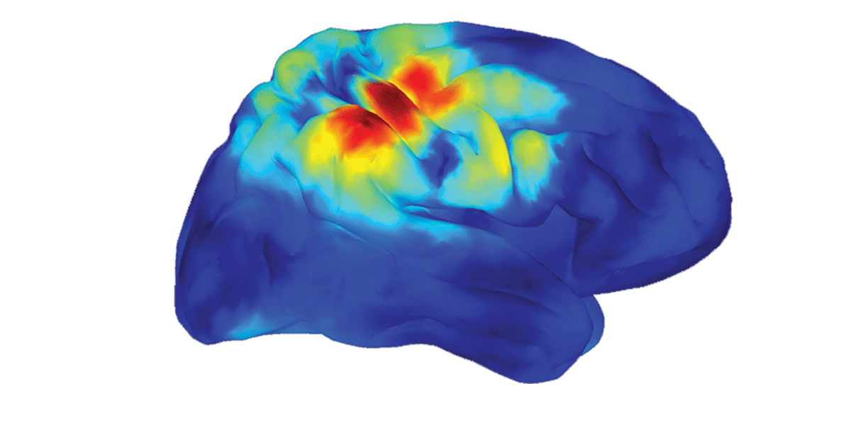 An AI Algorithm Decodes Speech From Brain Activity With Surprisingly High Accuracy - equinoxgroup.eu